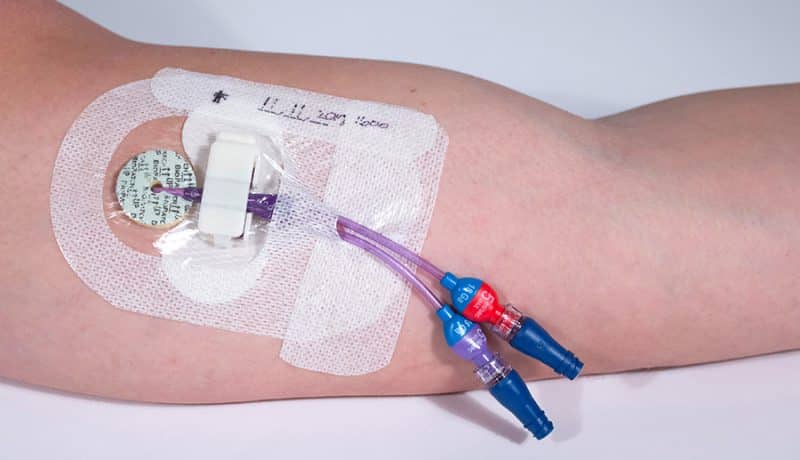 הדרכה ומידע על צנתר מרכזי מסוג PICC LINE - שירה מדיקל